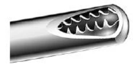 Stryker Resection Shaver Blade Formula™ XL Long Hip Stainless Steel St ...