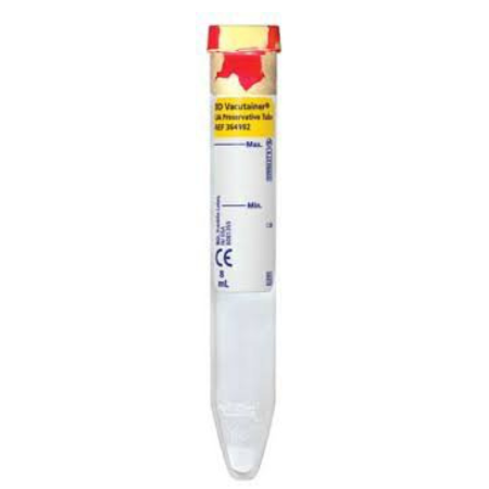 Becton Dickinson BD Vacutainer® Urinalysis Tube Conical Bottom Chlorhe ...